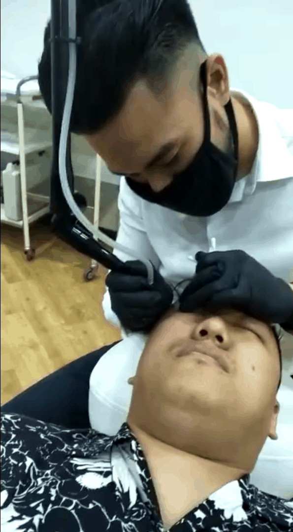 Effective Mole Removal Malaysia (Quick & Painless) - Veo Clinic